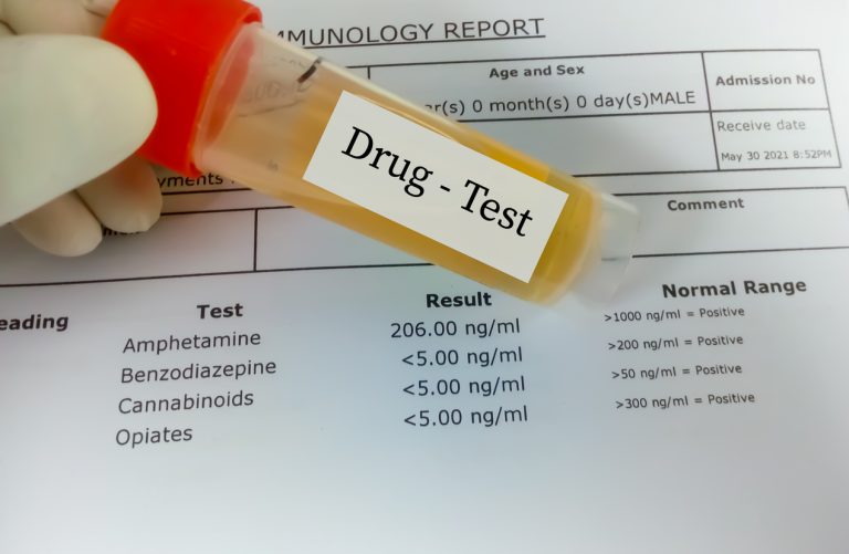 How Long Does Cannabis Stay In Your Urine? | CAC